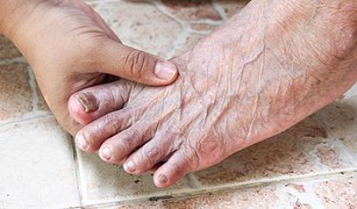 Toenail Care for Elderly